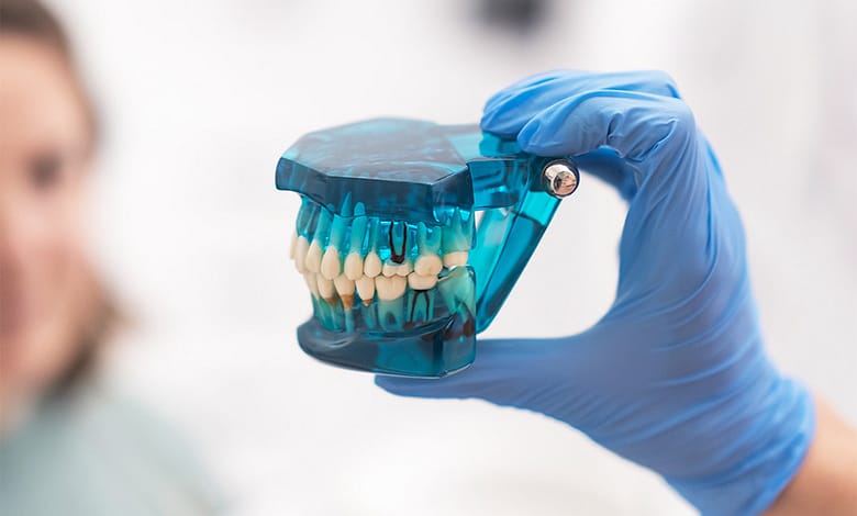 Bite Problems Malocclusion Dr Cheng S Dental Tips